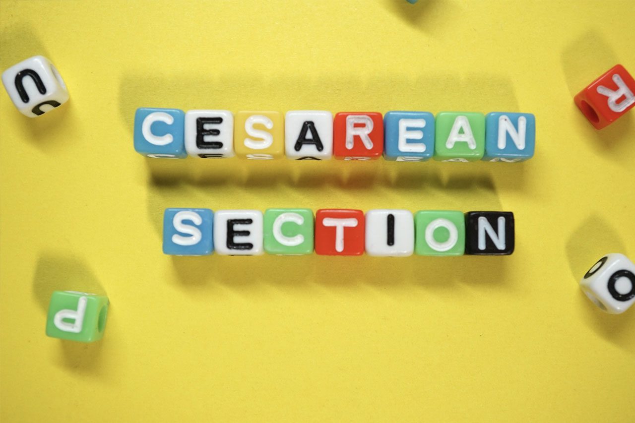 Cesarean Section Complete Guide For The Mother Host And Care Medical Journal